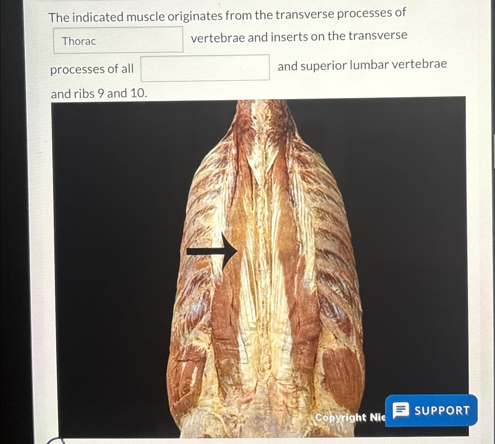 Solved The indicated muscle originates from the transverse | Chegg.com