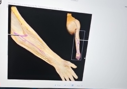 Solved which structure is indicated by the highlighting and | Chegg.com