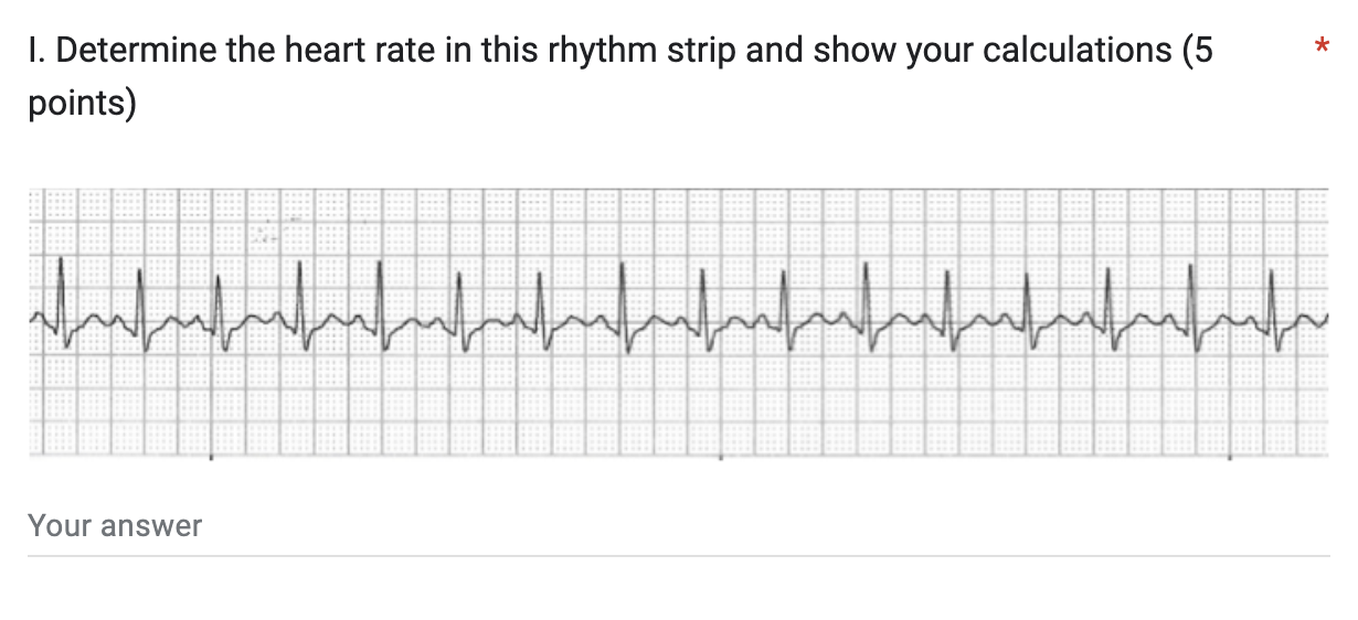 Solved I. Determine the heart rate in this rhythm strip and | Chegg.com