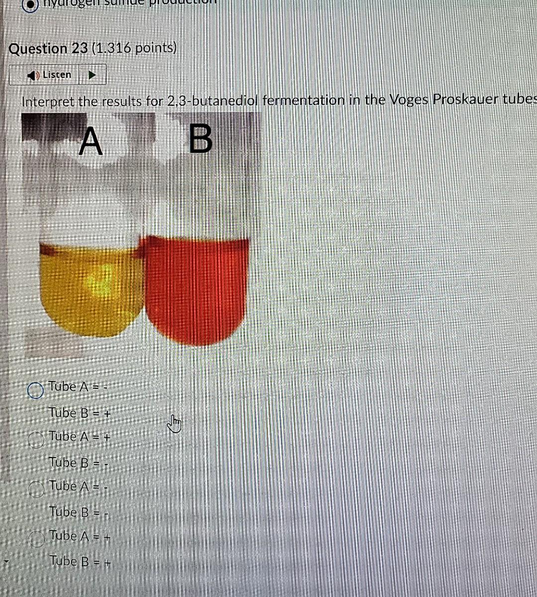 Solved Interpret the results of the Ornithine decarboxylase | Chegg.com