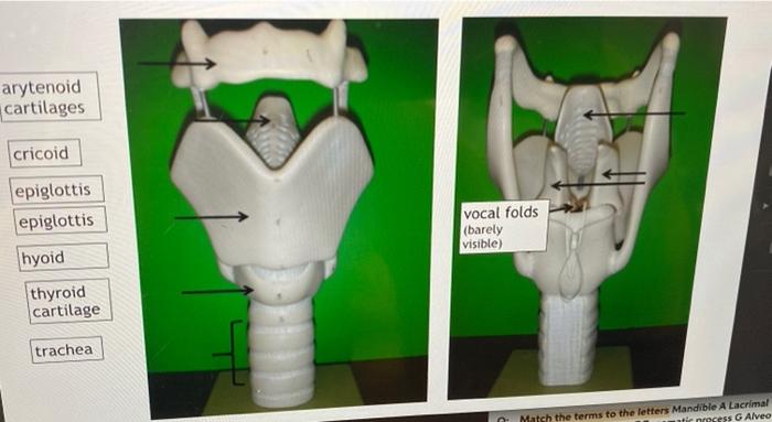 Solved arytenoid cartilages cricoid epiglottis epiglottis | Chegg.com
