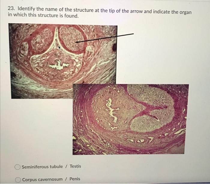 Solved 23. Identify the name of the structure at the tip of | Chegg.com