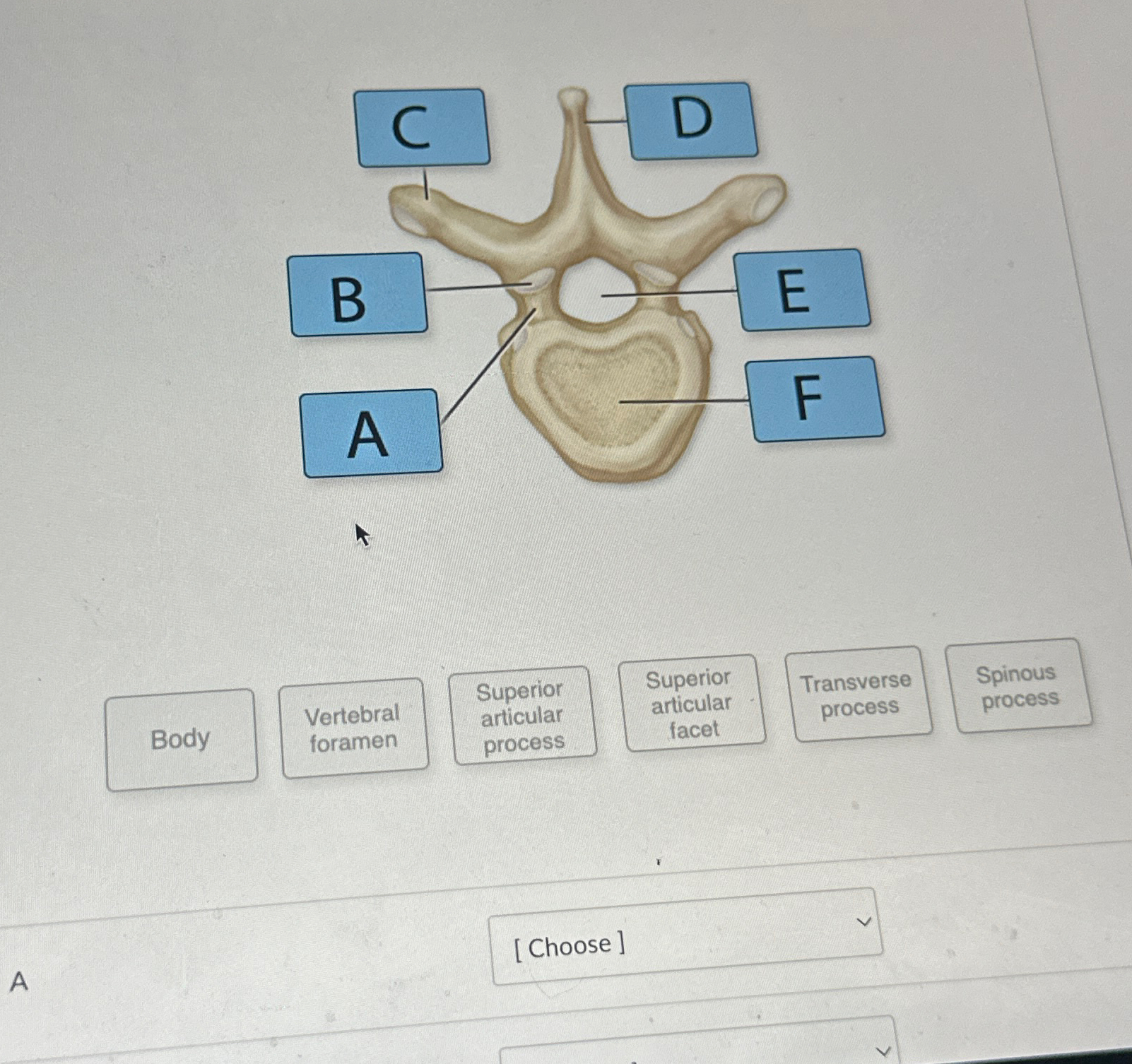 Solved BodyVertebralSuperiorSuperiorTransverseSpinousarticul | Chegg.com