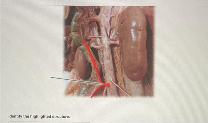 Solved Identifv the hiahliahted vessel. Identify the | Chegg.com Solved Identifv the hiahliahted vessel. Identify the | Chegg.com