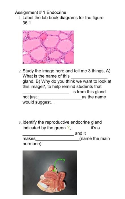 Assignment #1 Endocrine 1. Label the lab book | Chegg.com