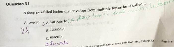 Solved which is the correct answer and is the multiple | Chegg.com