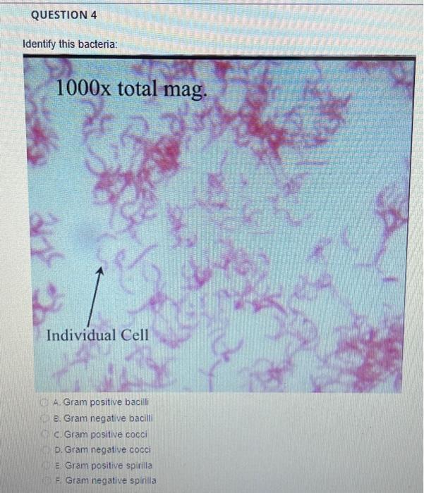 Solved A. Gram positive bacilli B. Gram negative bacili C. | Chegg.com