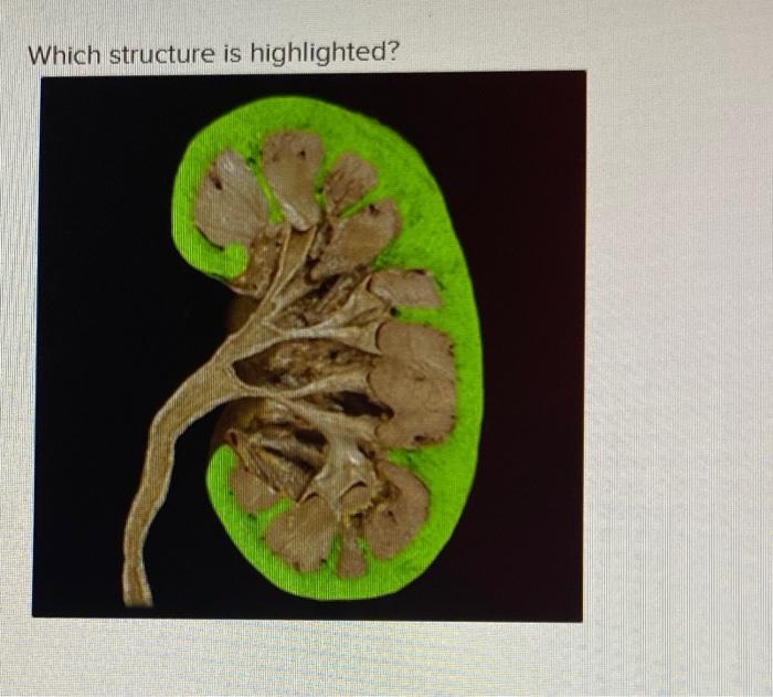 Solved Which structure is highlighted? Multiple Choice | Chegg.com