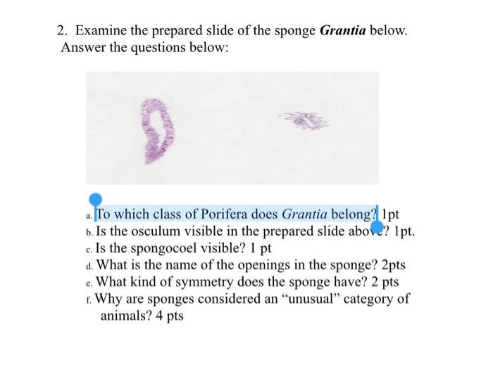 Solved 2. Examine the prepared slide of the sponge Grantia | Chegg.com