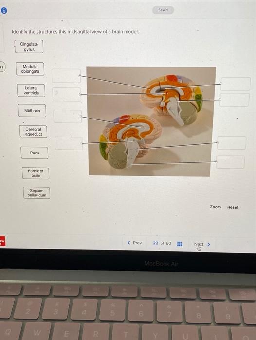 Solved Identify the structures on this midsagittal view of a | Chegg.com