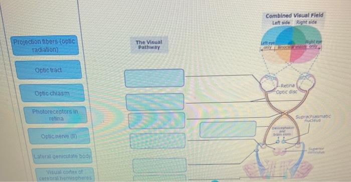 Solved Combined Visual Field Left side Right side right | Chegg.com