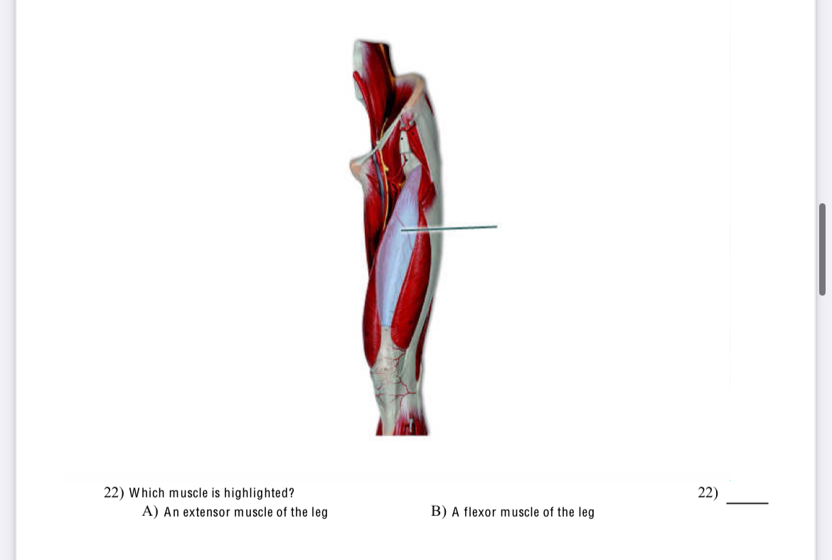 Solved Which muscle is highlighted?A) ﻿An extensor muscle of | Chegg.com