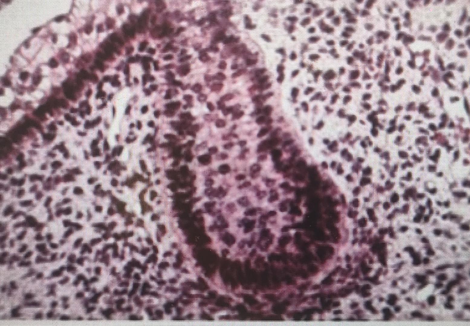 Solved is this in bud stage? I don't know which stage of | Chegg.com