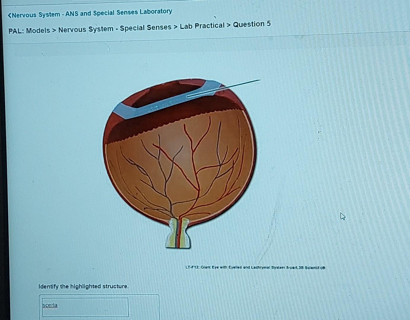 Solved Nervous System - Special Senses > Lab Practical > | Chegg.com