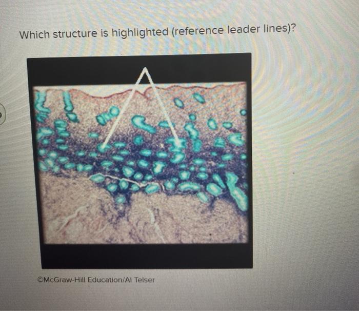 Which structure is highlighted (reference leader | Chegg.com
