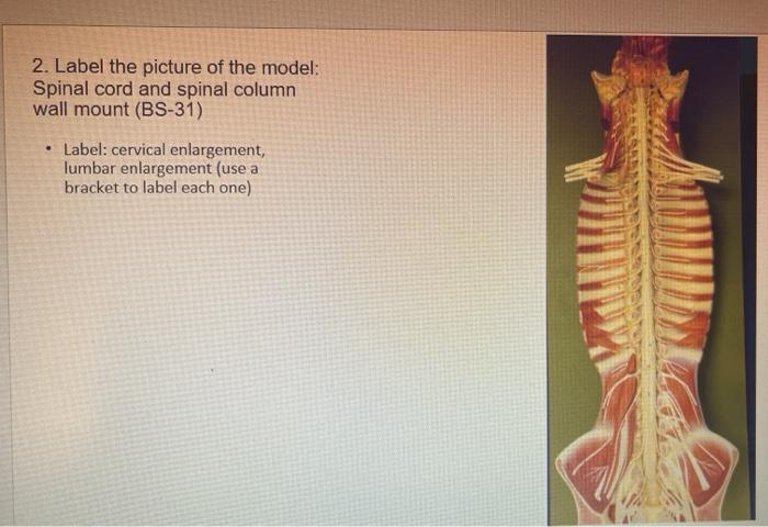 2. Label the picture of the model: Spinal cord and | Chegg.com