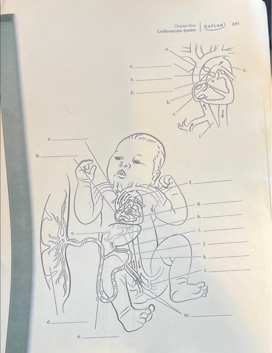 Solved Veins Chante Cardiovascular System KAPLAN 21 b. m c | Chegg.com