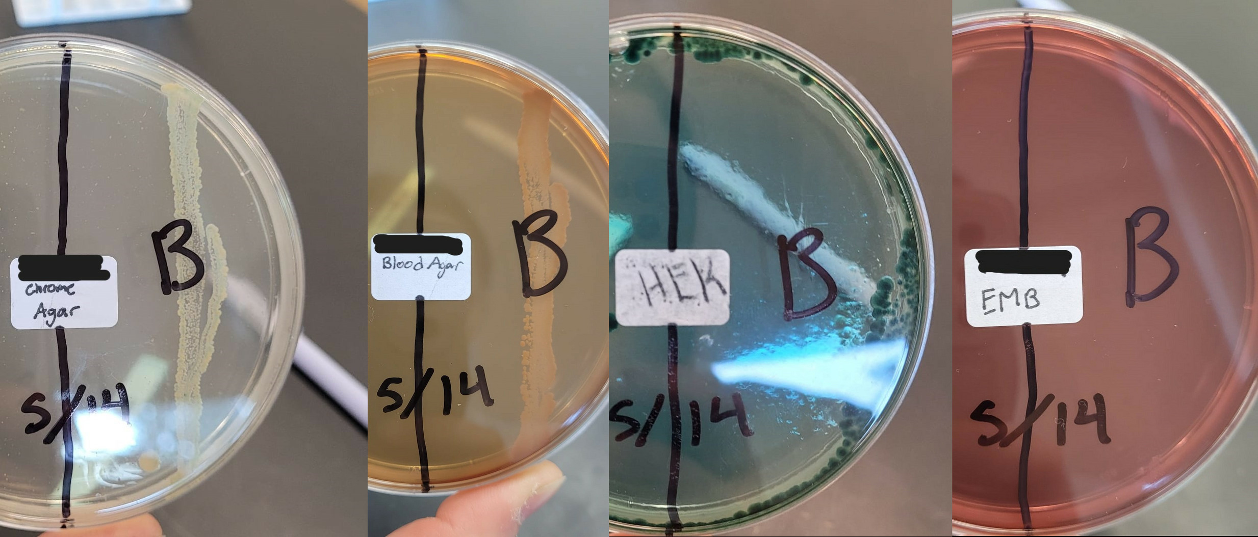 Solved Chromagar, Hektoen (has no growth), ﻿Blood Agar, EMB | Chegg.com