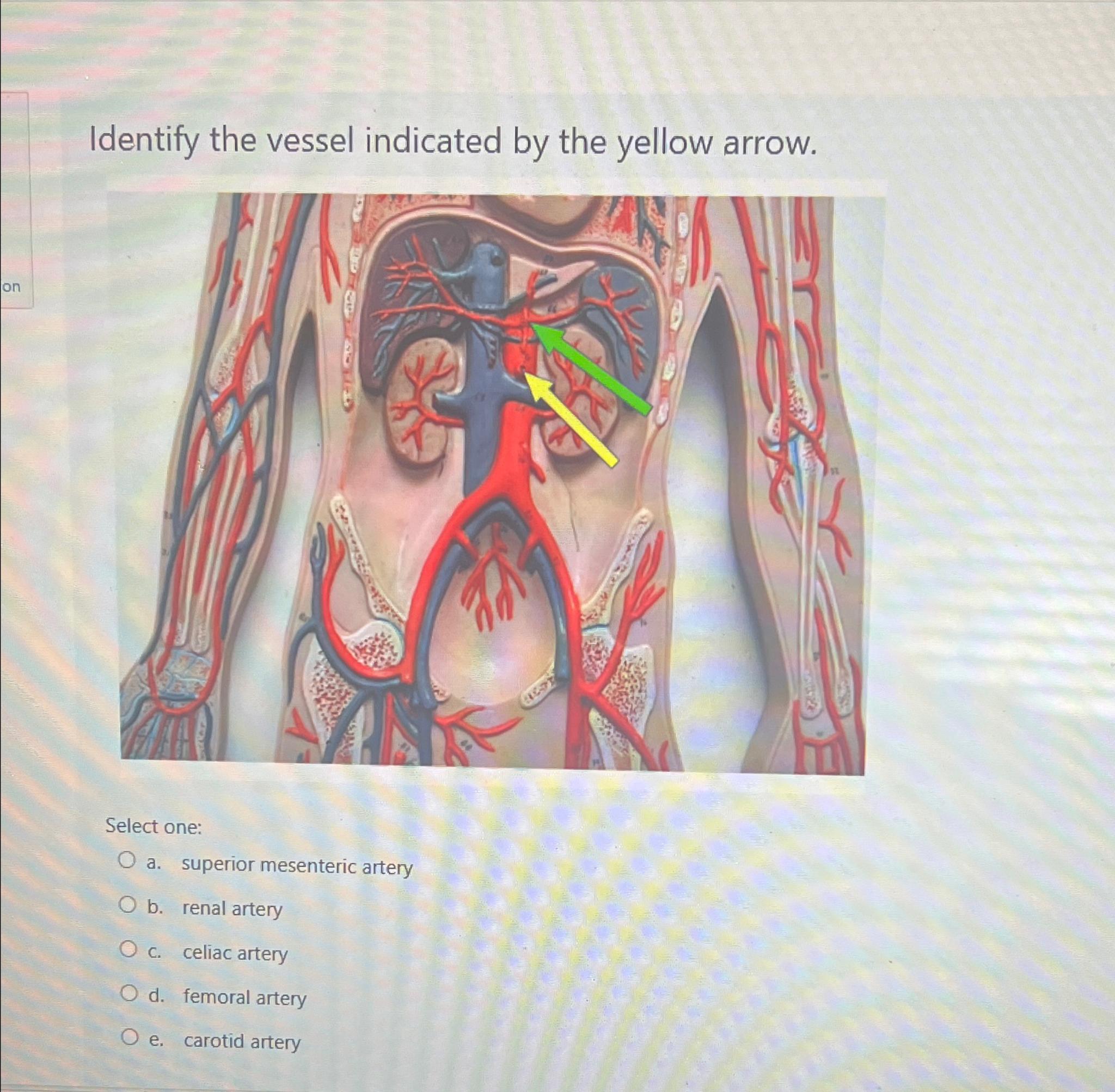 Solved Identify the vessel indicated by the yellow | Chegg.com
