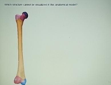 Solved Which structure cannot be visualized in this | Chegg.com