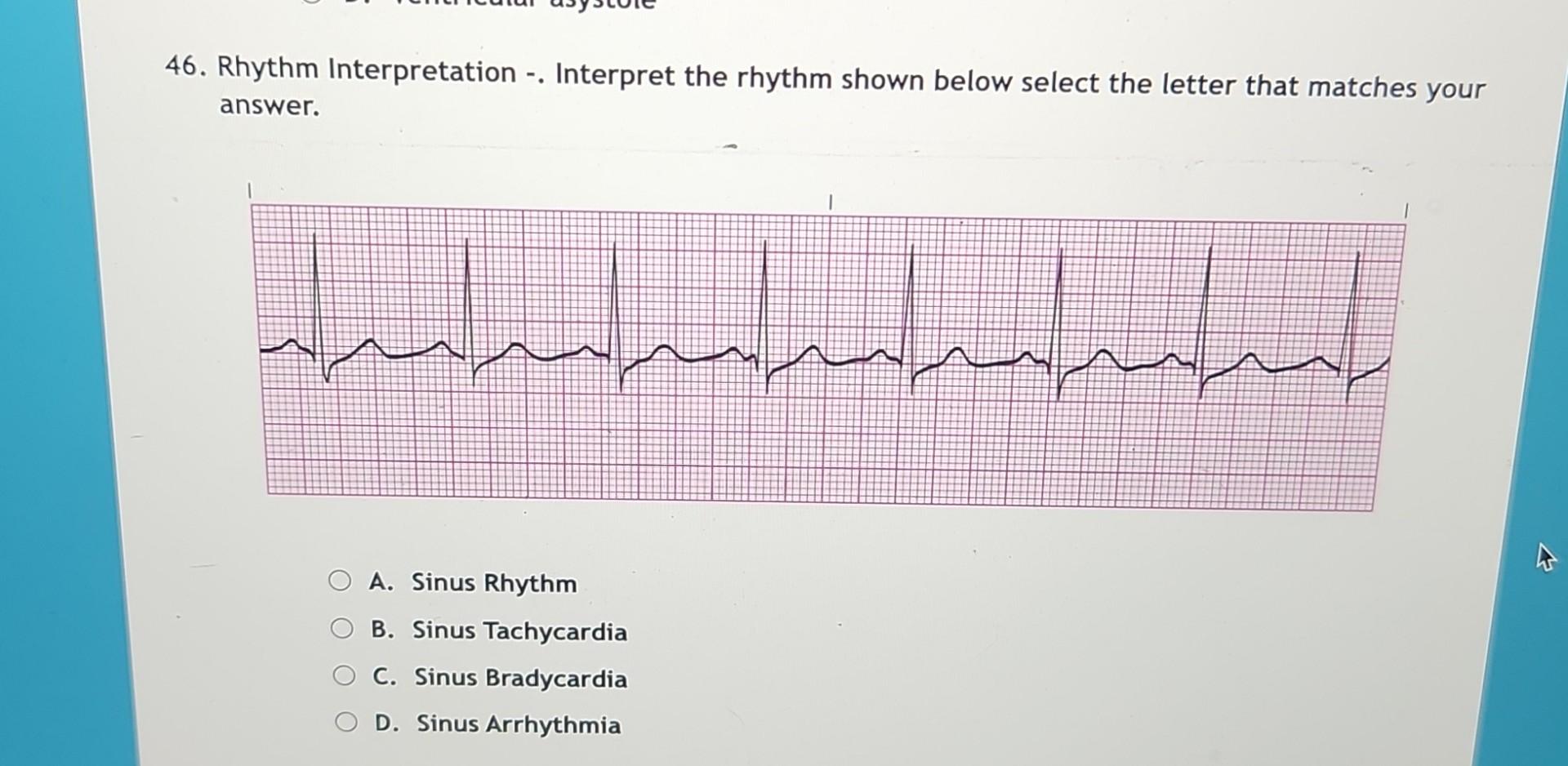 Solved 46. Rhythm Interpretation -. Interpret the rhythm | Chegg.com