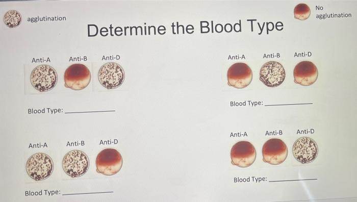 Solved agglutination Determine the Blood Type No | Chegg.com