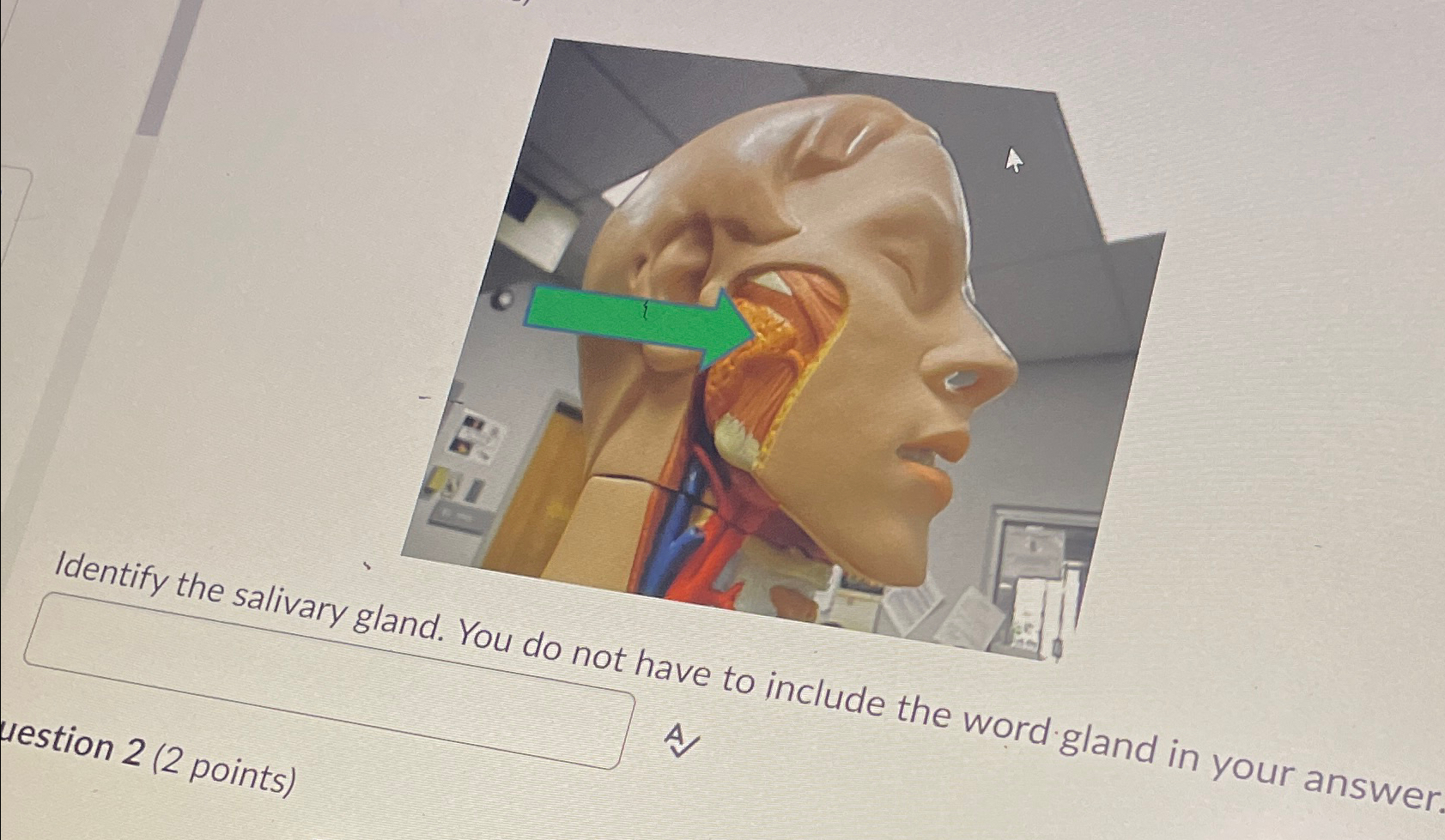 Solved Identify the salivary gland (at the arrow) | Chegg.com