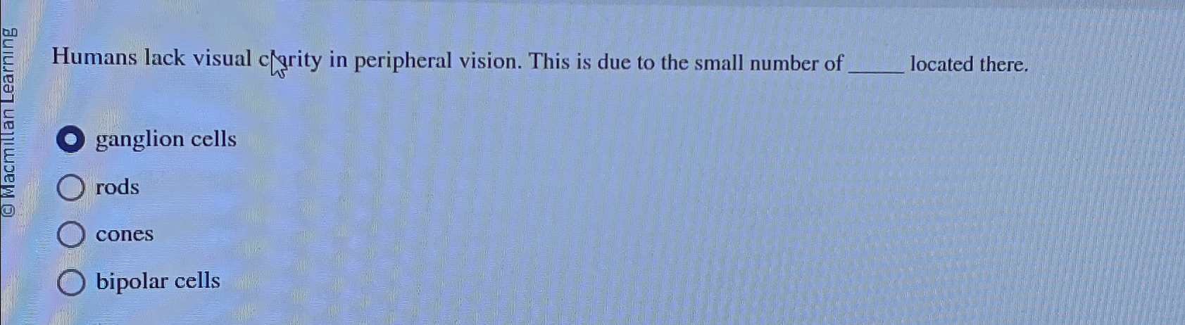 Solved Humans lack visual cyrity in peripheral vision. This | Chegg.com