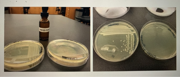 Solved Results 1. Starch Hydrolysis Record your results and | Chegg.com
