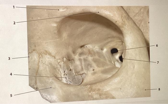 Solved 1 Supraorbital tissure 2 Nasal bone 3 Zygomatic bone | Chegg.com