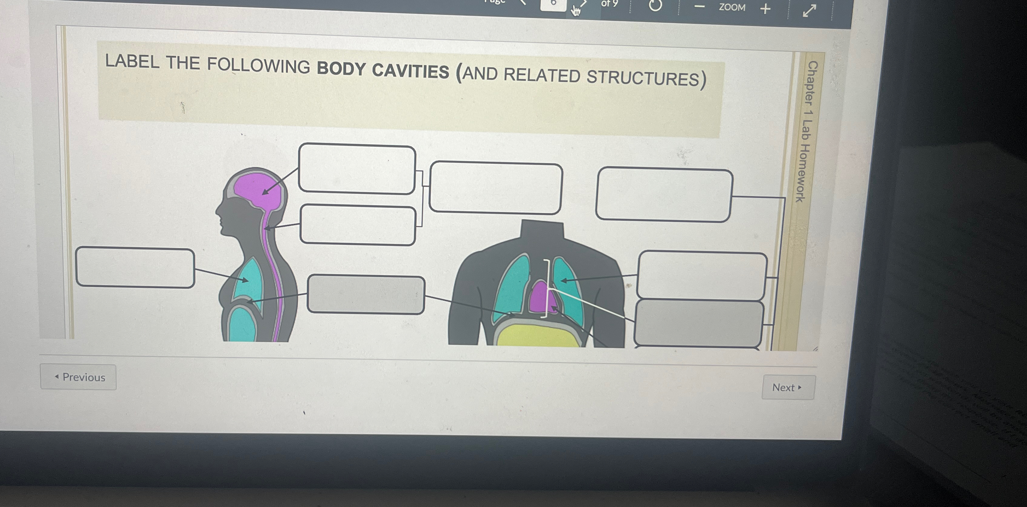 Solved LABEL THE FOLLOWING BODY CAVITIES (AND RELATED | Chegg.com