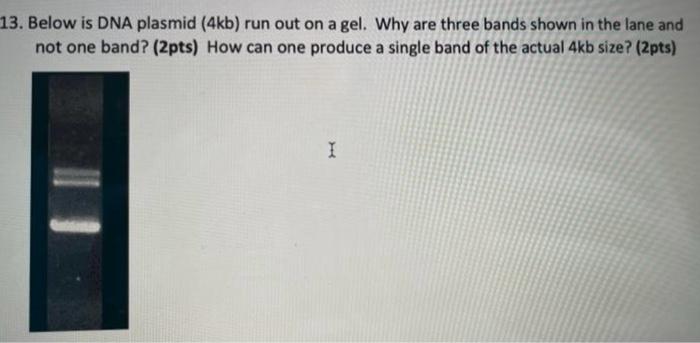 Solved 13. Below is DNA plasmid ( 4 kb) run out on a gel. | Chegg.com