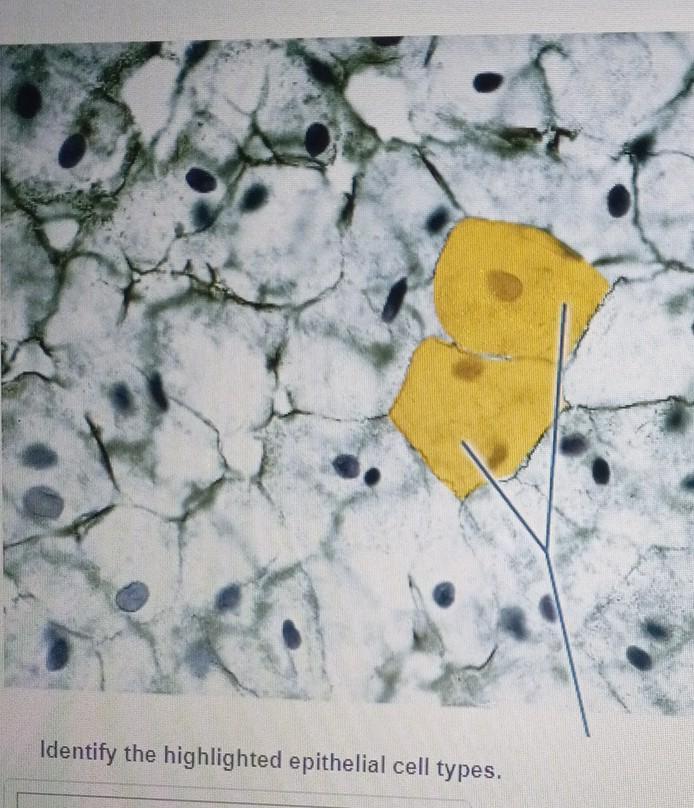Solved Identify the highlighted epithelial cell types. | Chegg.com