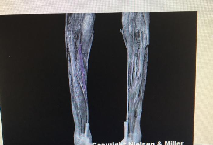 Solved 8)Identify the highlighted vessels. 7) Identify the | Chegg.com