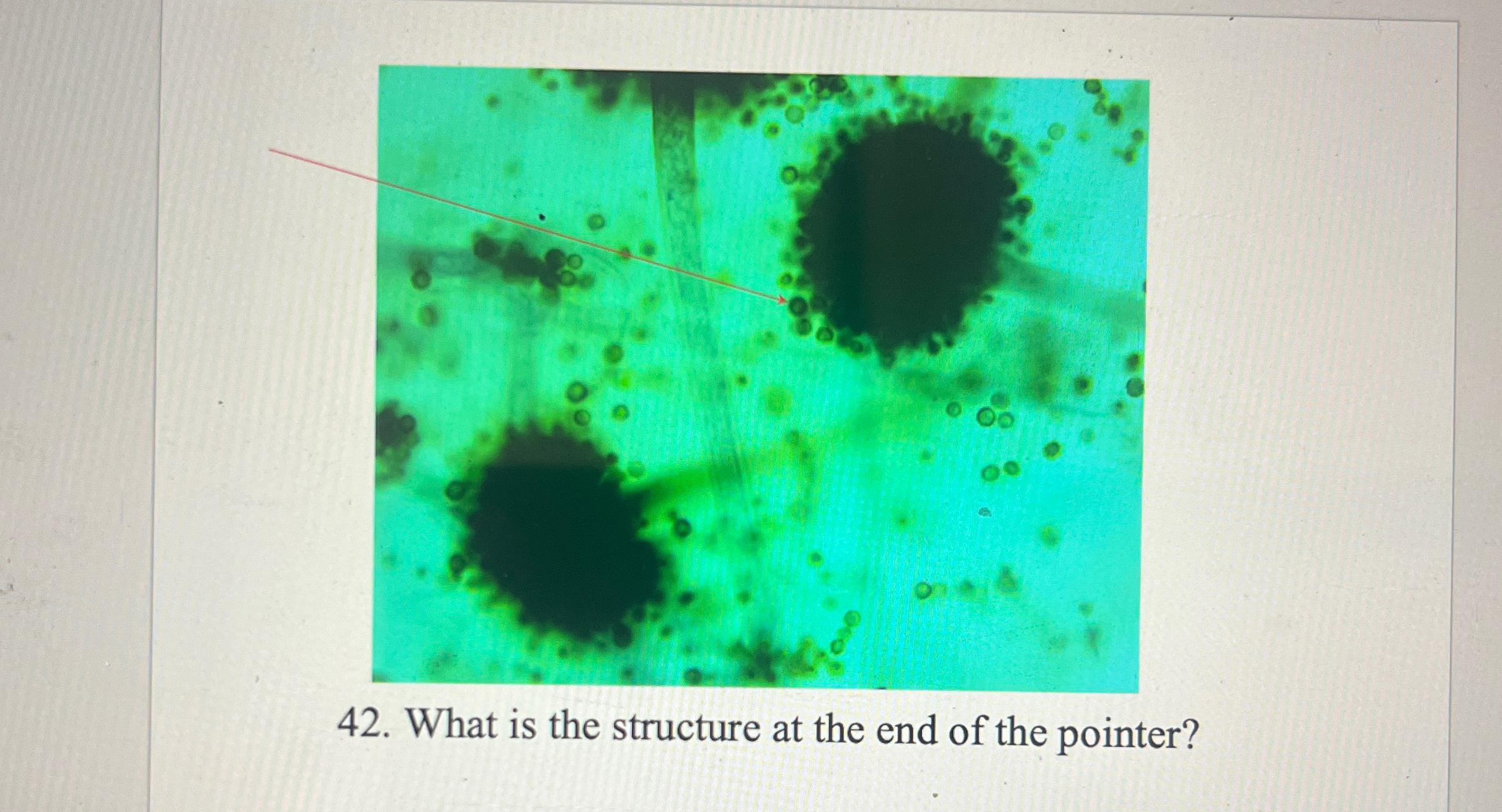 What is the structure at the end of the pointer? | Chegg.com