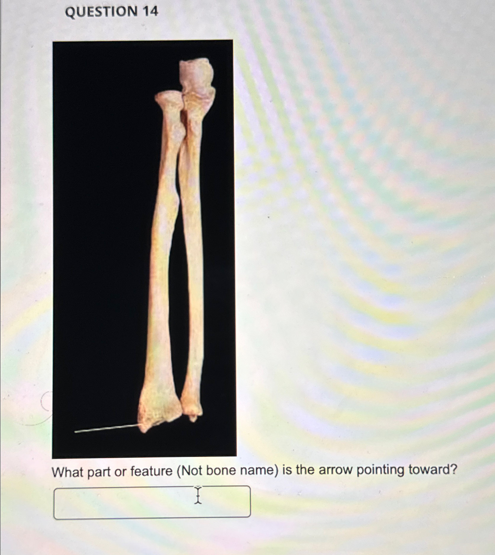 Solved QUESTION 14What part or feature (Not bone name) ﻿is | Chegg.com