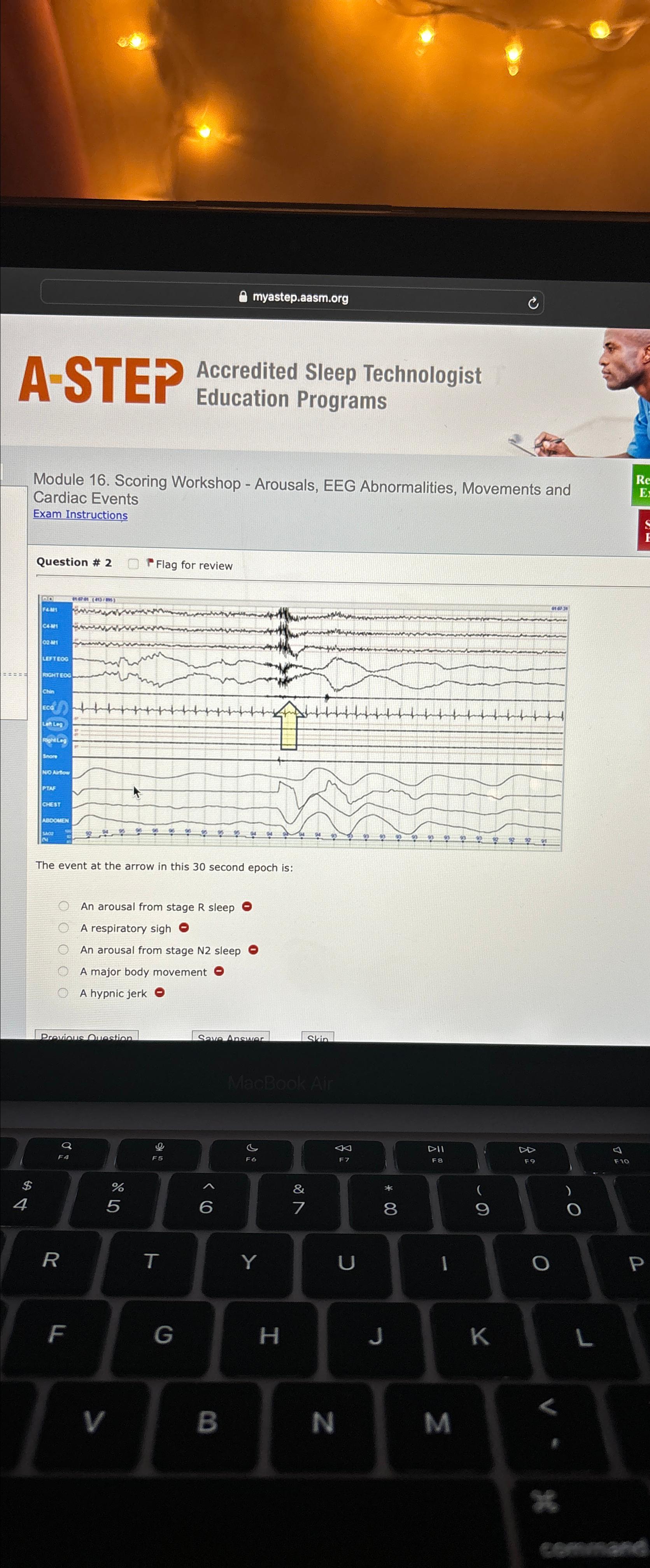 Solved myastep.aasm.orgA-STEPAccredited Sleep Technologist | Chegg.com