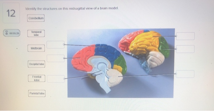 Solved Identify the structures on this midsagittal view of a | Chegg.com