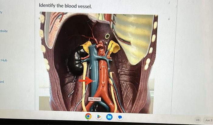 Solved Identify the blood vessel. | Chegg.com