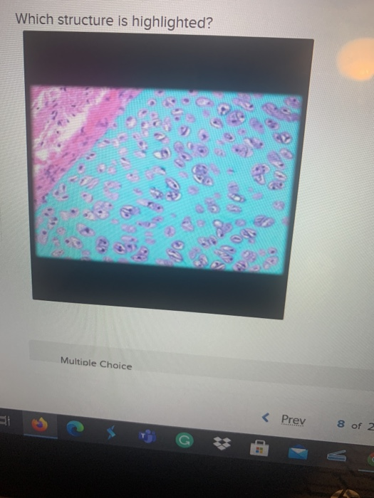 Solved Which structure is highlighted? Multiple Choice