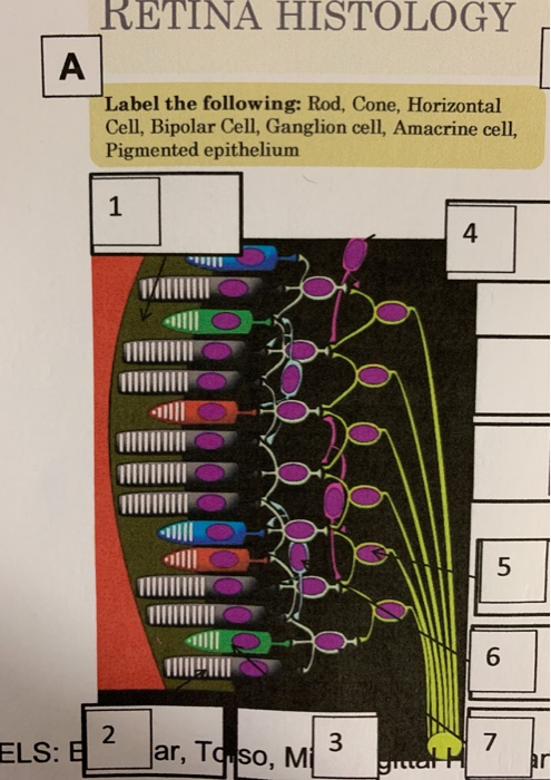 Solved RETINA HISTOLOGY Label the following: Rod, Cone, | Chegg.com