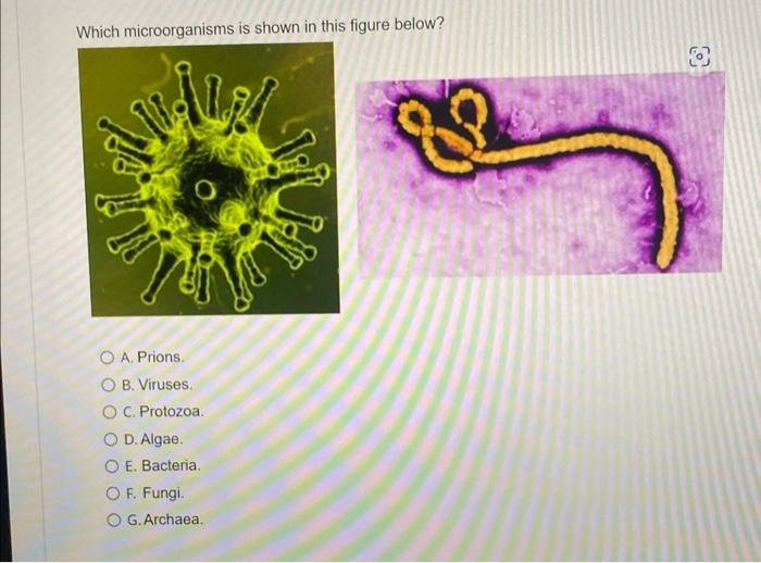 Solved Which microorganisms is shown in this figure below? | Chegg.com