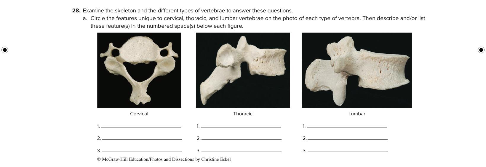 Solved Examine the skeleton and the different types of | Chegg.com