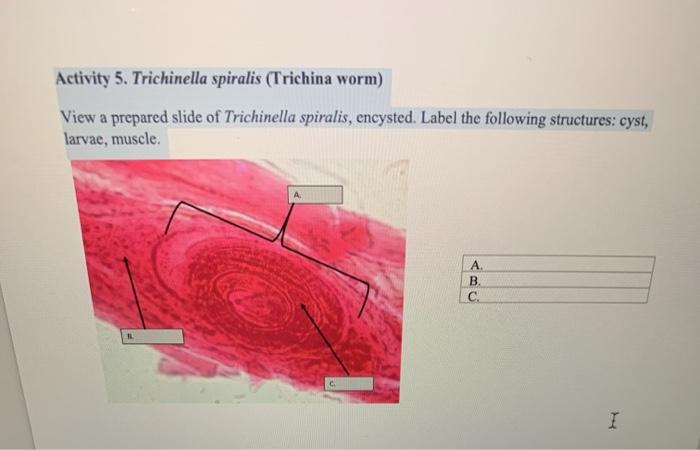 Solved Activity 5. Trichinella spiralis (Trichina worm) View | Chegg.com