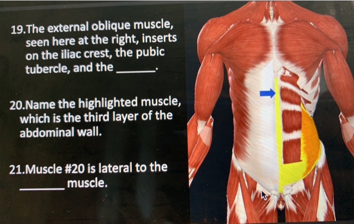 Solved 1. What is the name of the yellow highlighted muscle? | Chegg.com