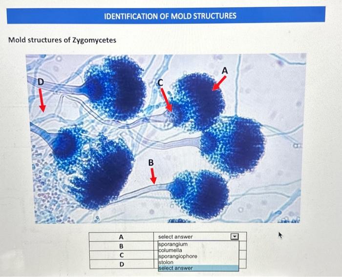 Solved Mold structures of Zygomycetes\begin{tabular}{|l|l|} | Chegg.com