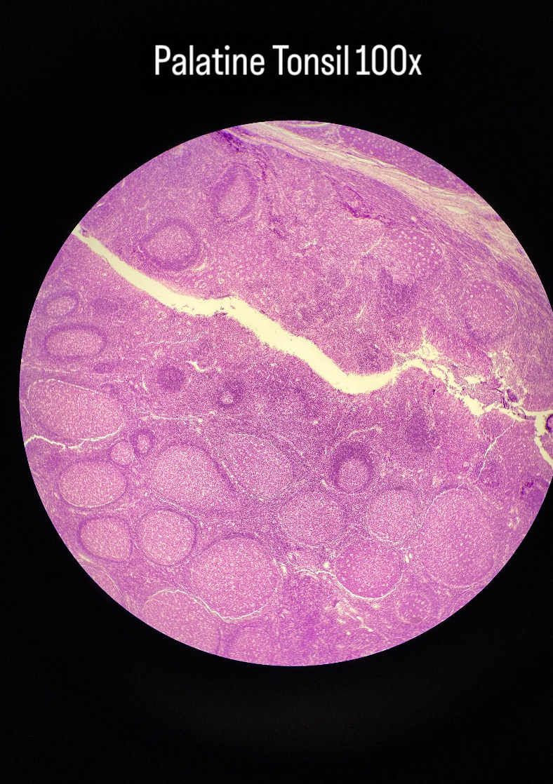 Solved Palatine Tonsil 100xLabel on the slide please The | Chegg.com