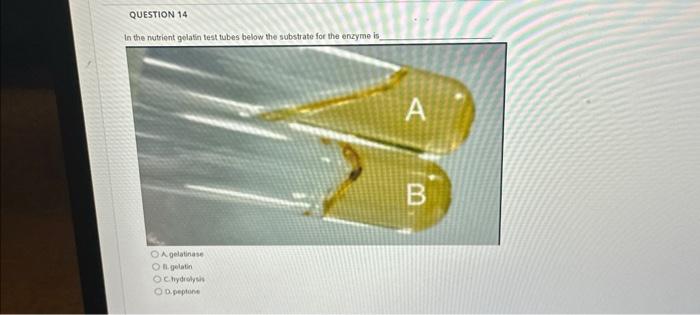 Solved QUESTION 14 In the nutrient gelatin test tubes below | Chegg.com