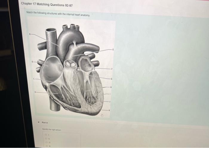 Chapter 17 Matching Questions 92.97Mech the folowing | Chegg.com