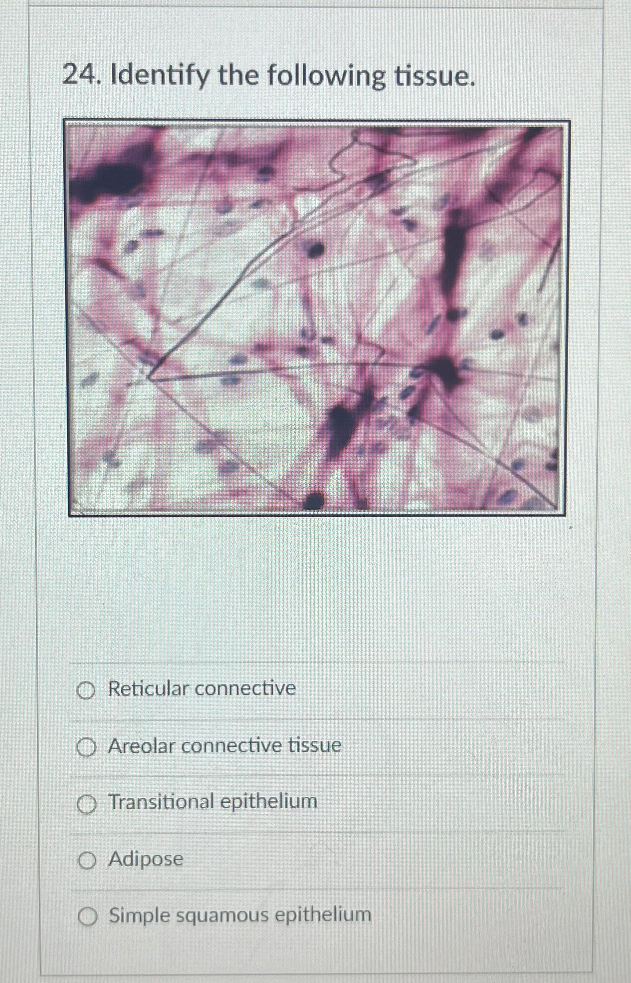Solved Identify the following tissue.Reticular | Chegg.com